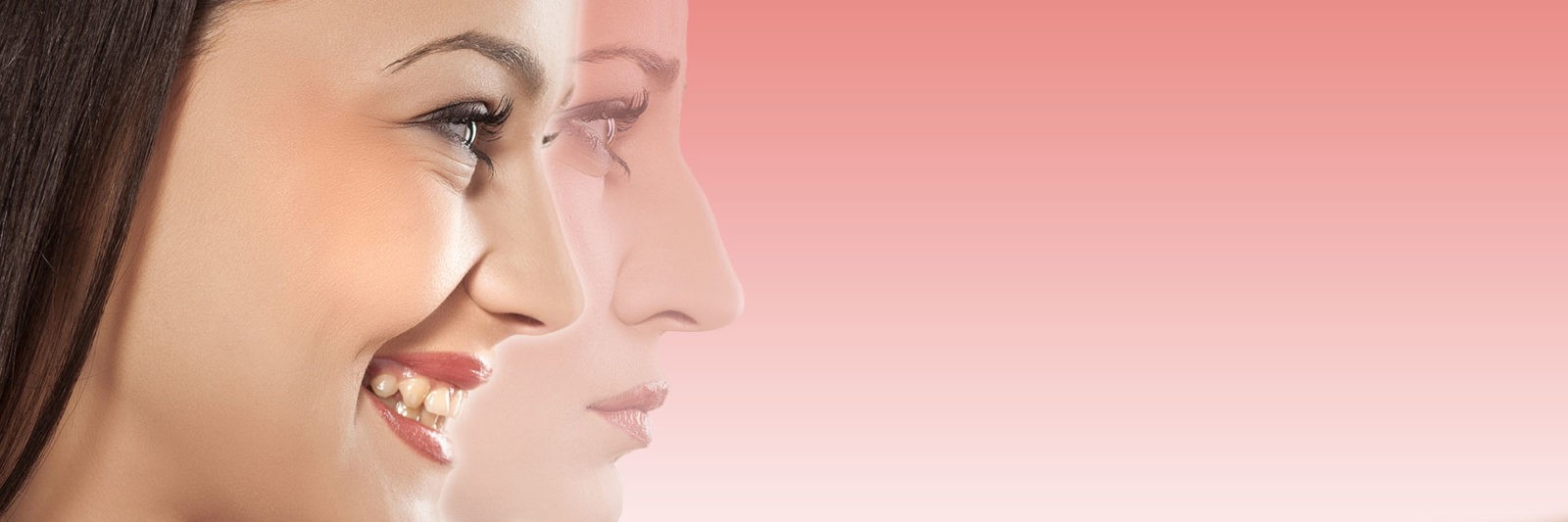 Plastic Surgery in Tijuana: What is a Good Rhinoplasty? - VIDA Wellness ...