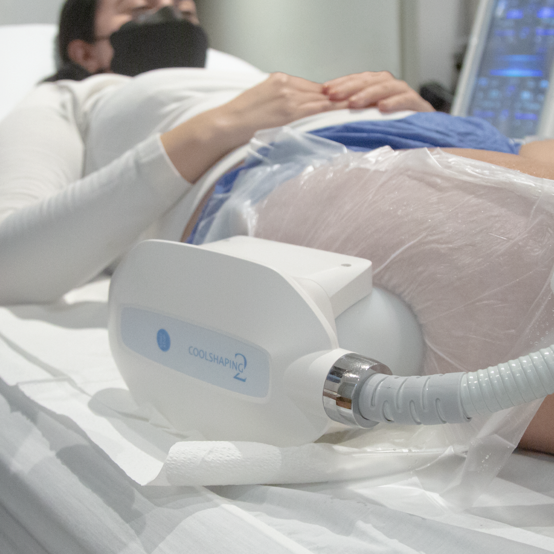 CoolShaping Procedure in Mexico | Video Wellness