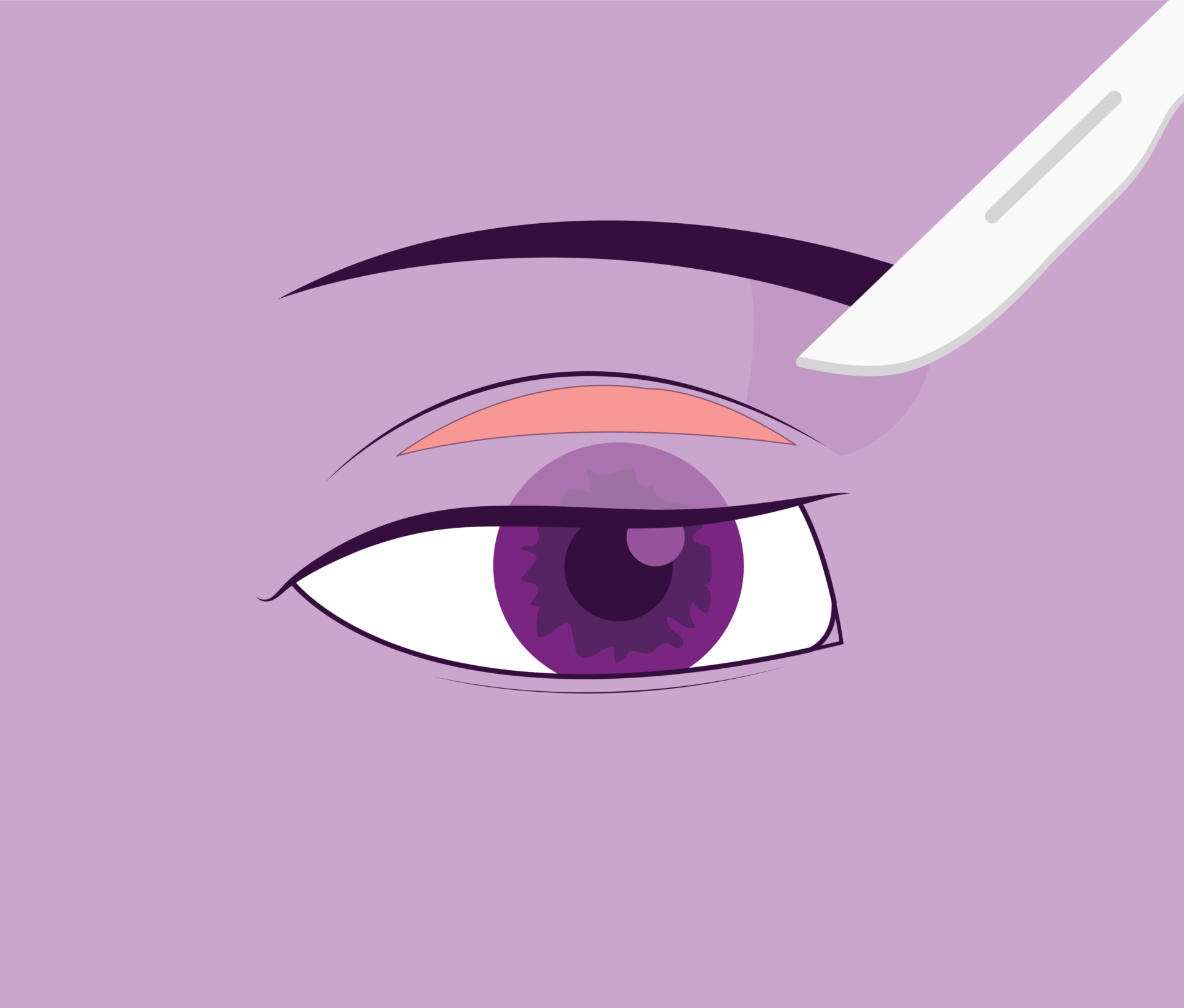 Asymmetrical Eyes: How to Fix Asymmetrical, Uneven, and Droopy Eyelids