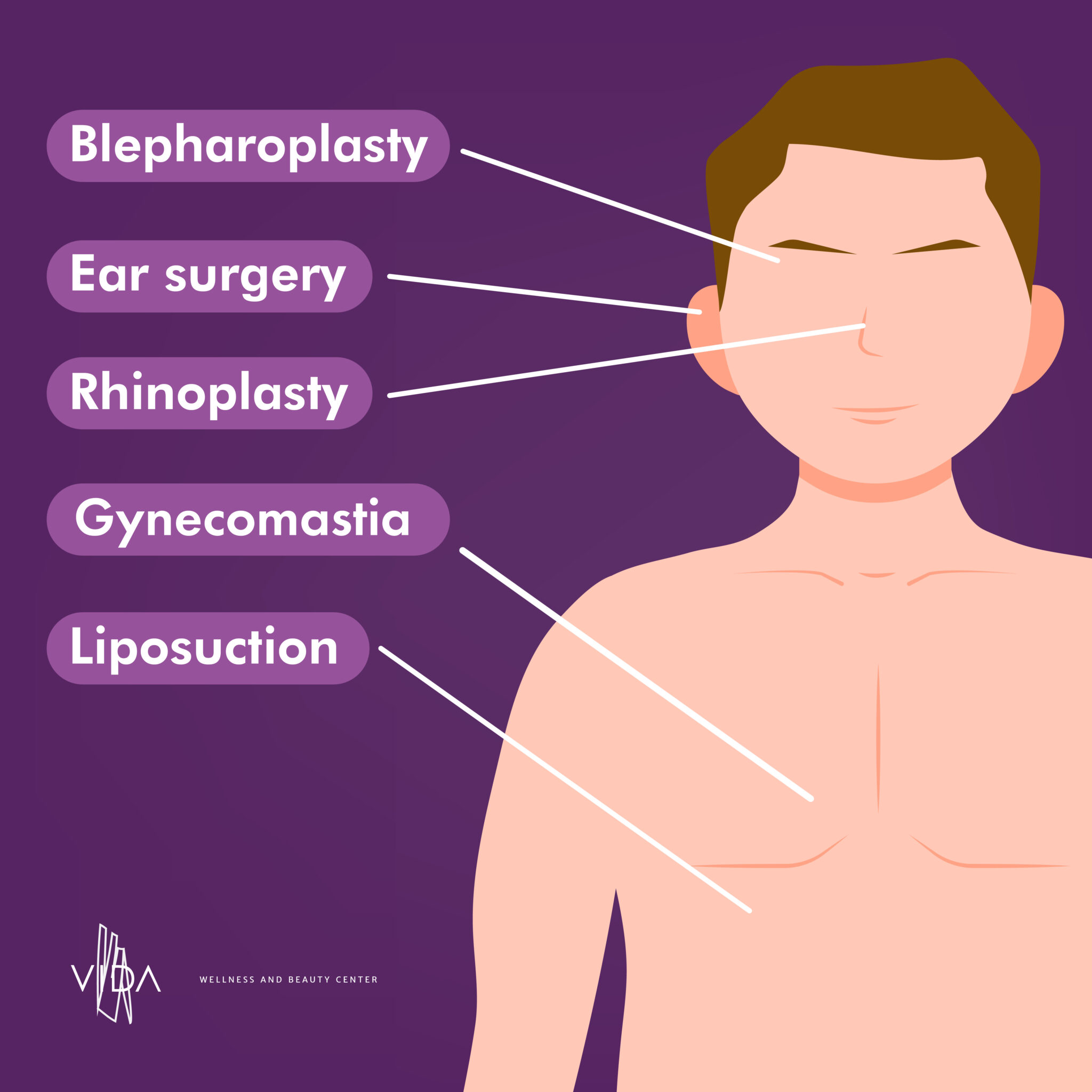 Male plastic surgery trends for summer - VIDA Wellness and Beauty